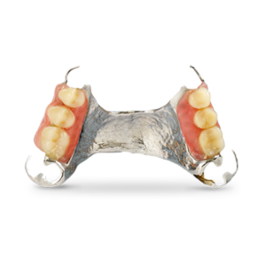 Metal Framework Partials - DCS Dental Lab